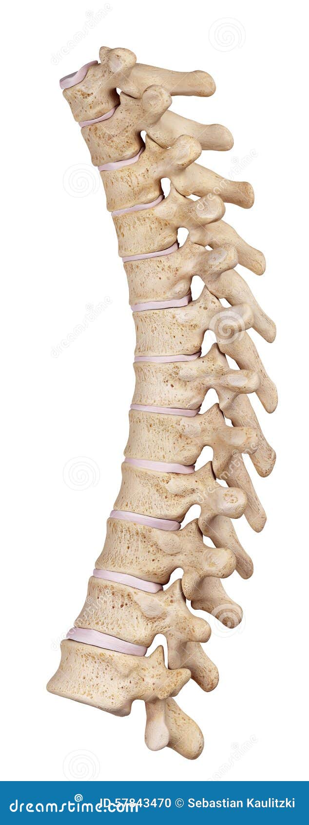 Thoracic Spine Pain As Soft Tissue Muscle Inflammation Outline Diagram ...