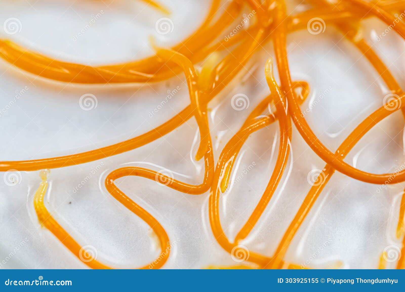 Thorny-headed Worms, or Spiny-headed Worms and Ascaris Under the ...