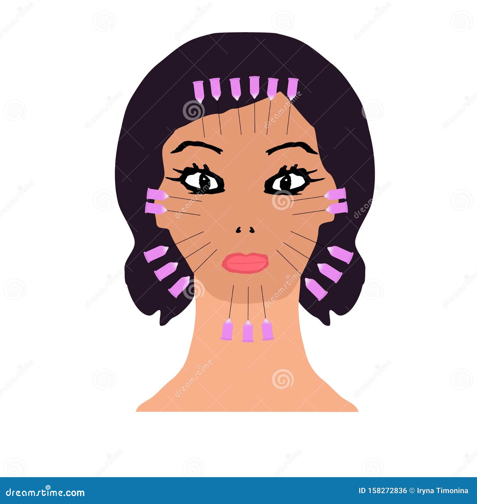 Mesotherapy Threads Lifting. Different Types Of Threads For Facelift ...