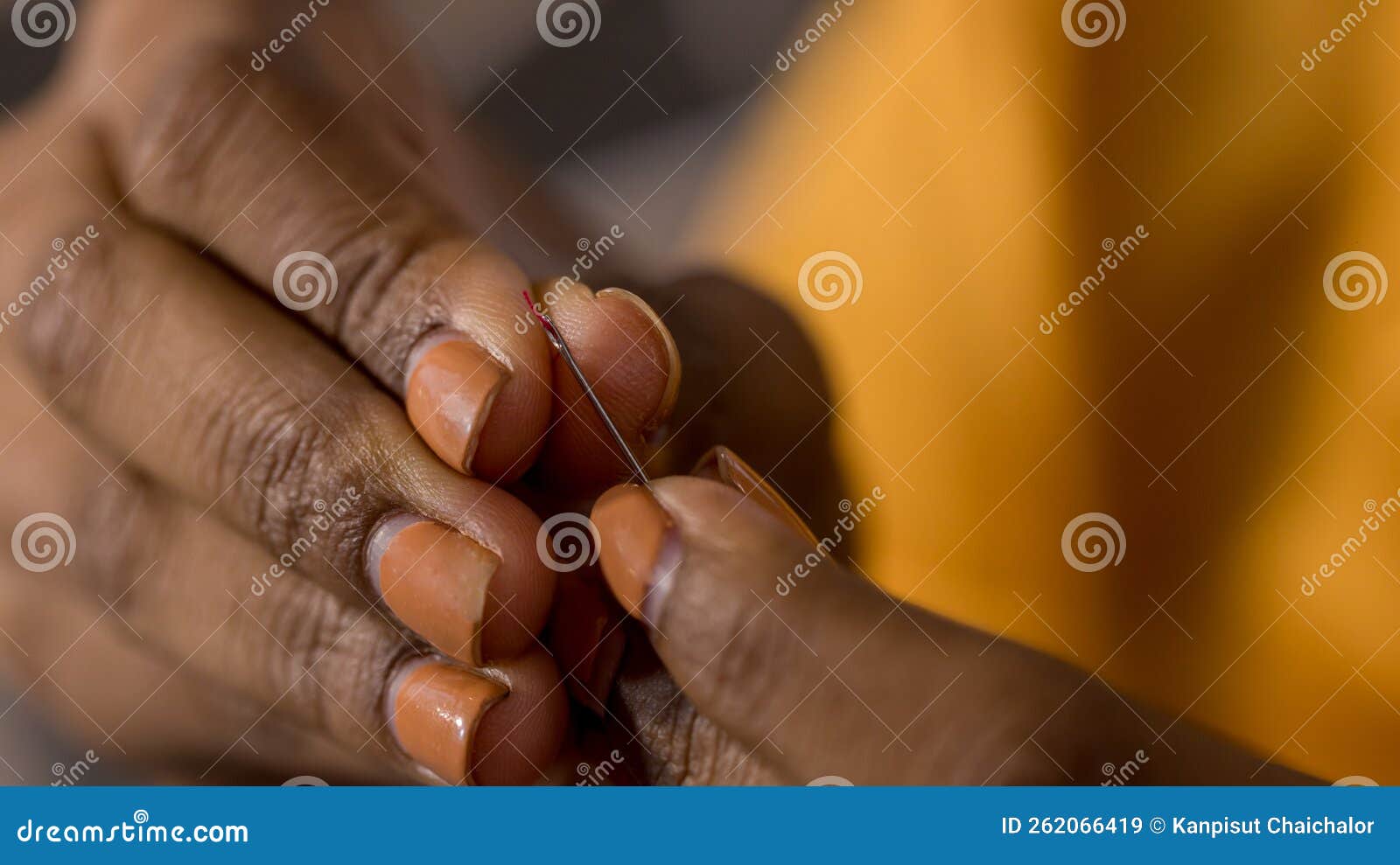 Needle And Hands Of Physiotherapist Doing A Dry Needling In Silhouette ...