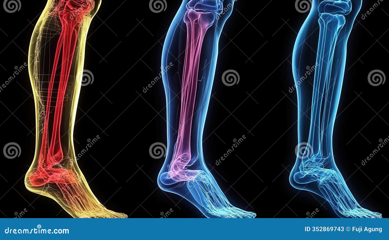 Three Color Variations of a Human Lower Leg Bone Anatomy Illustration ...