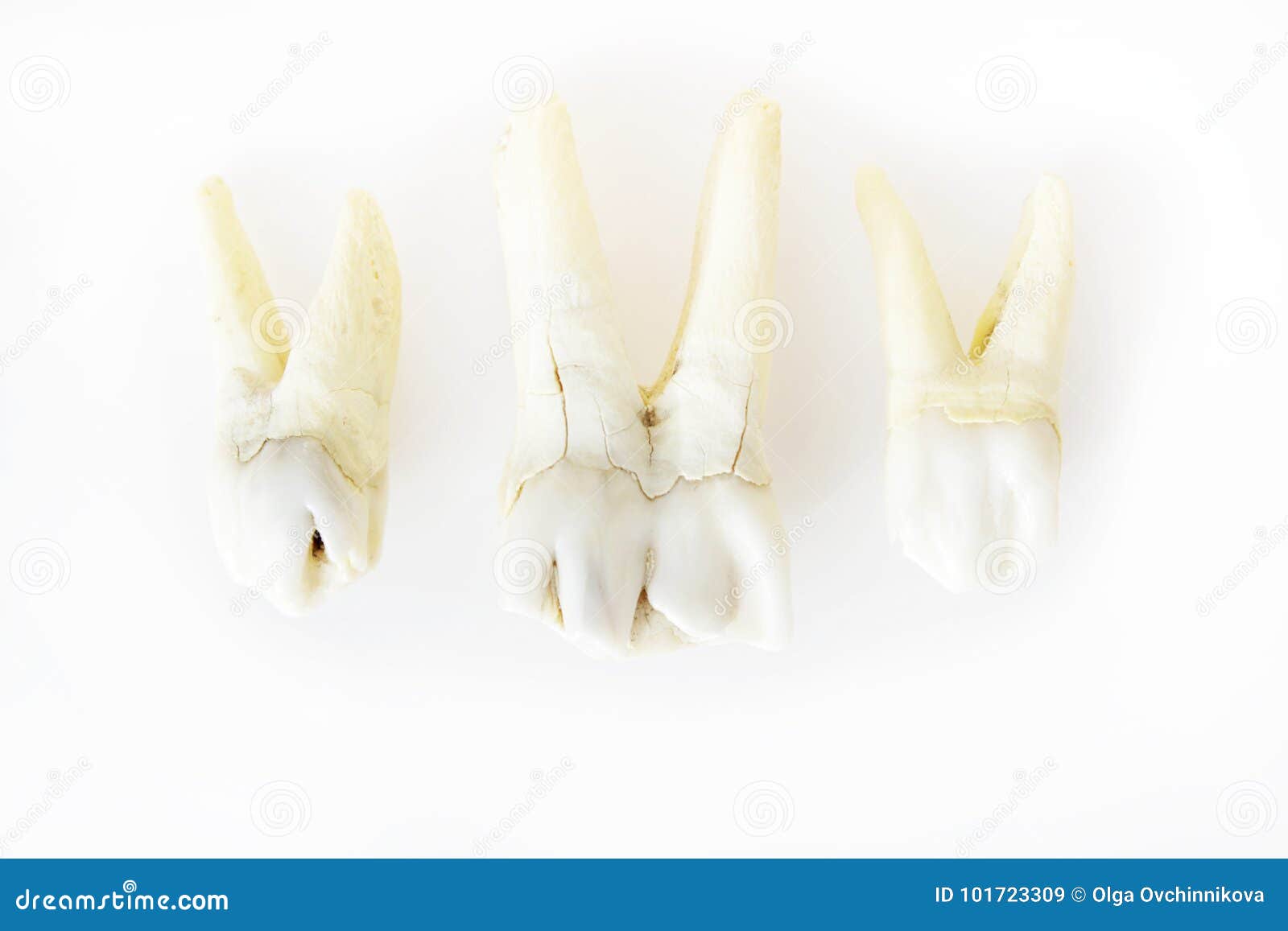 Three Cow S Teeth with Roots on a White Background. Stock Image - Image ...
