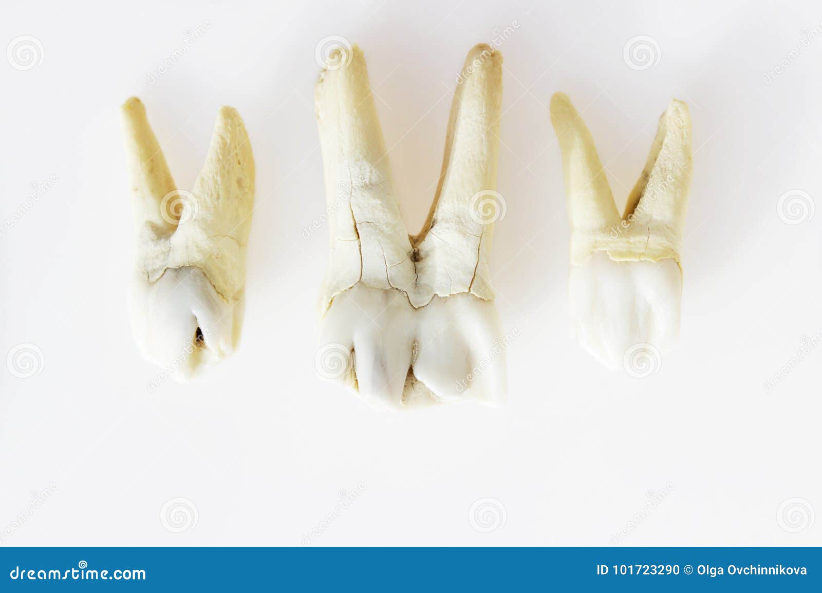 Three Cow S Teeth with Roots on a White Background. Stock Photo - Image ...