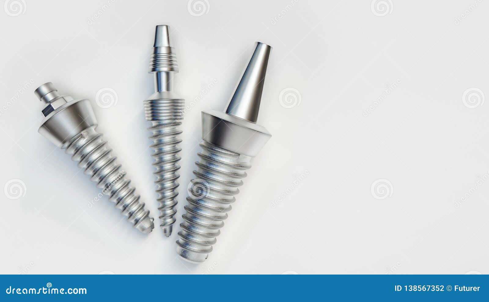 Three Different Tooth Implants- 3D Rendering Stock Illustration ...