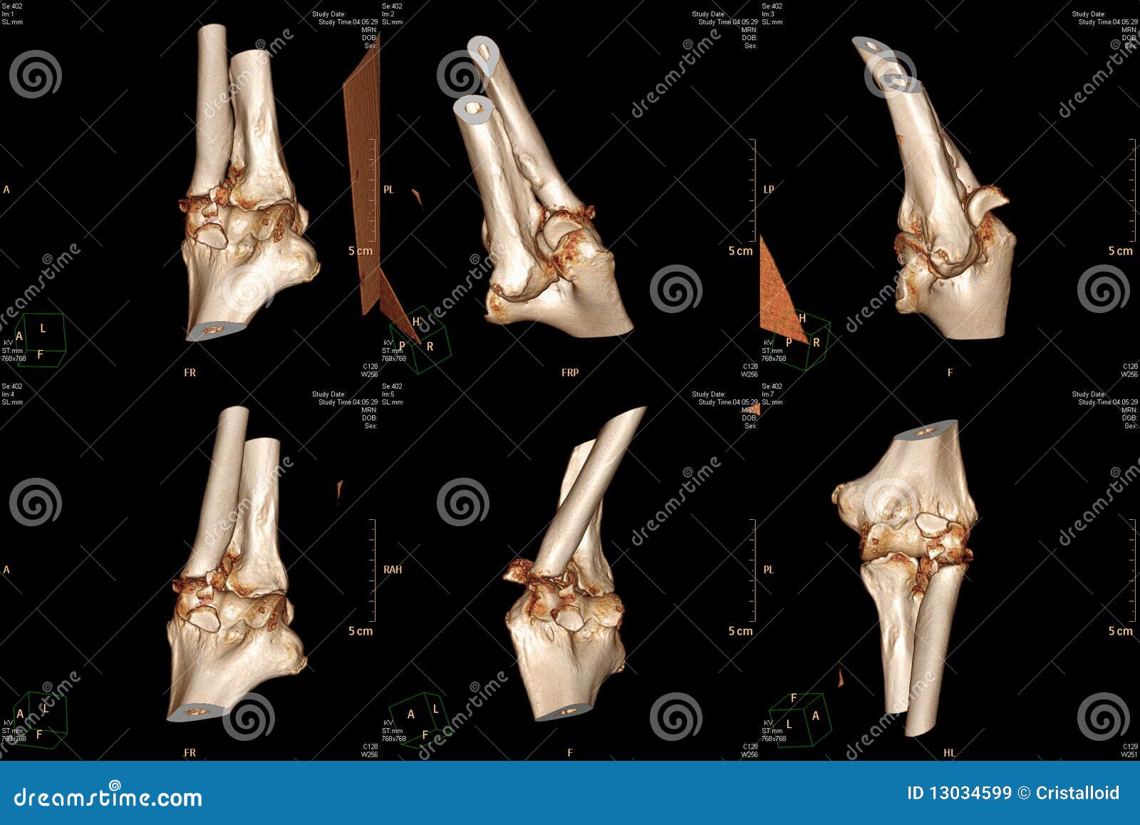 Three-Dimensional elbow stock image. Image of dimensional - 13034599