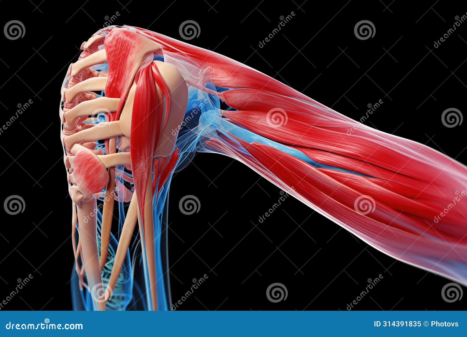 Three Dimensional Representation Emphasizing Inflammation of Joints, As ...