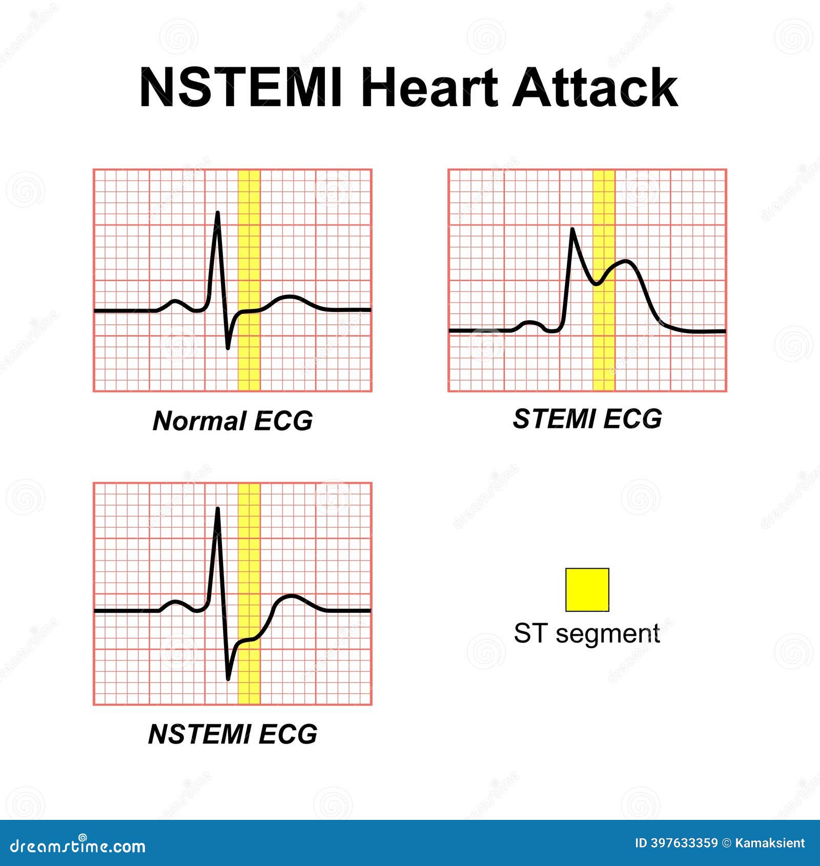 Heartdisease Cartoons, Illustrations & Vector Stock Images - 98 ...