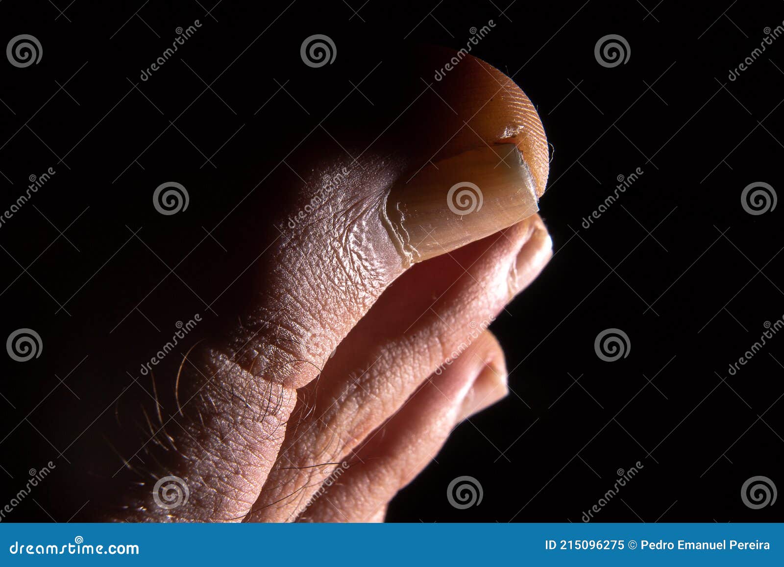 Three Human Toes With Illumination On The Right Side Under Black ...
