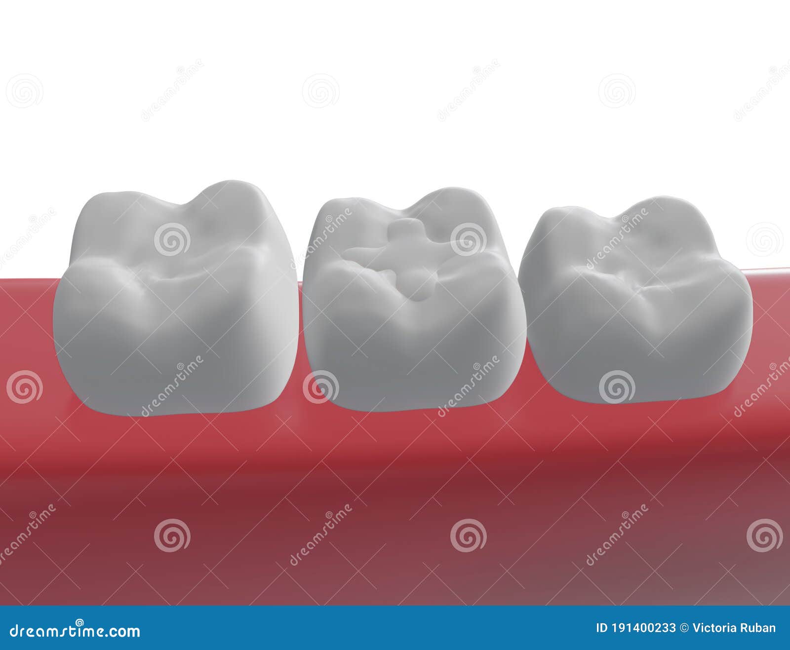 Three Molar Teeth in the Gum Stock Illustration - Illustration of ...