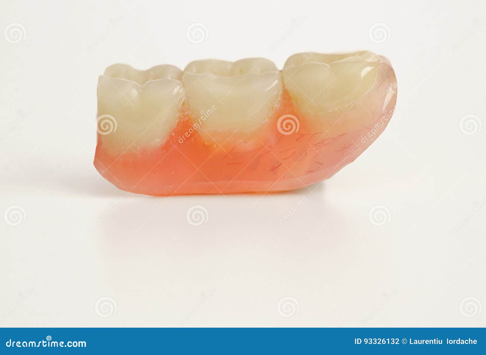 Three prosthetic teeth stock photo. Image of dentistry - 93326132