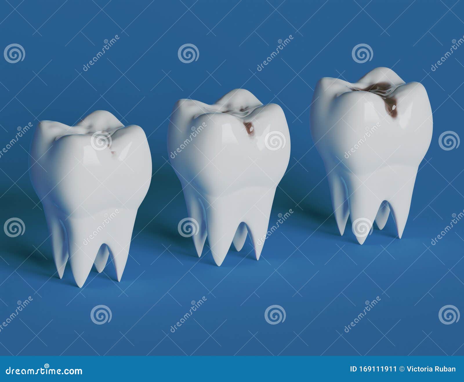 Three Tooth Anatomy Illustrations Cartoon Vector | CartoonDealer.com ...