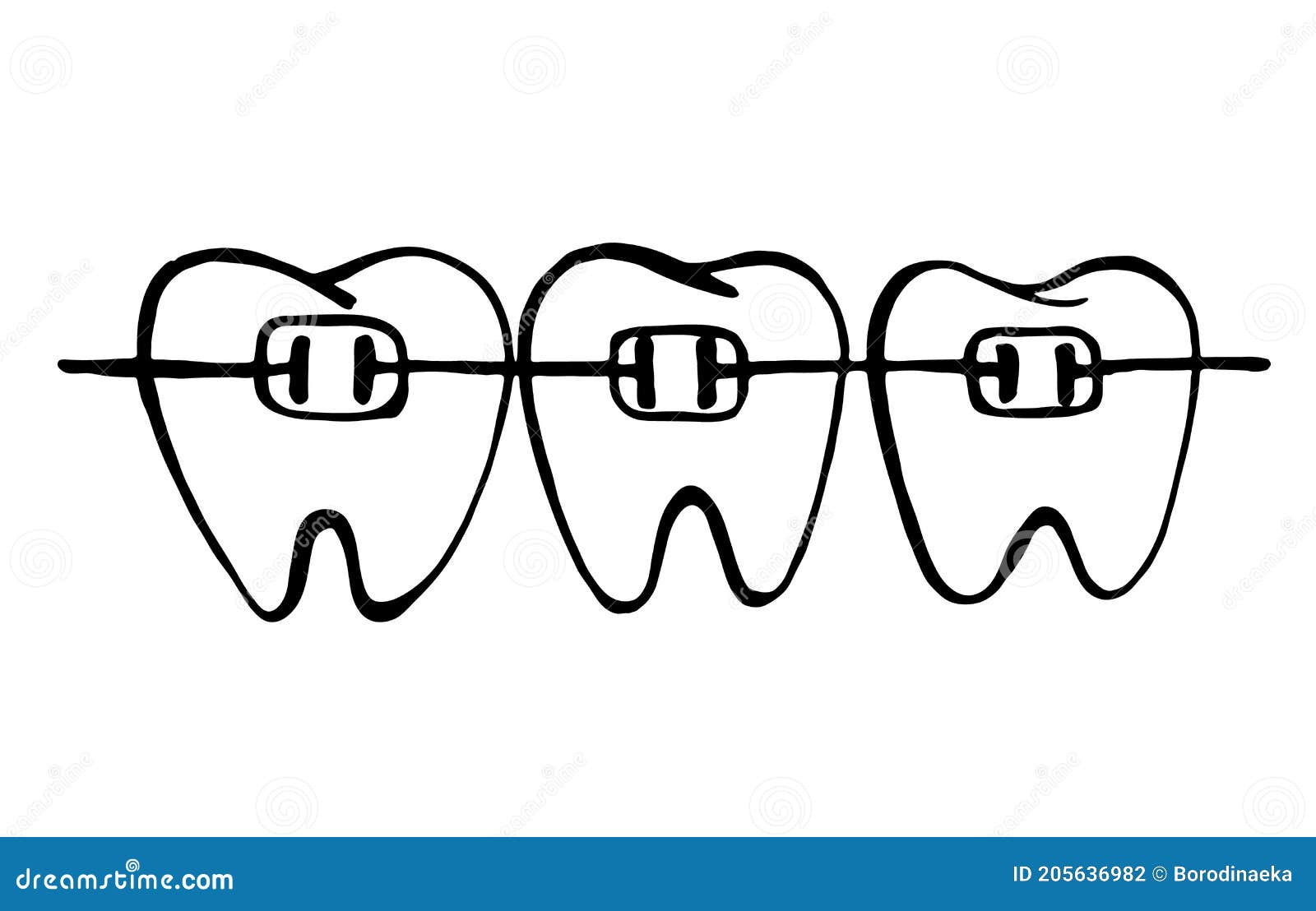 Three teeth with braces. stock vector. Illustration of facial - 205636982