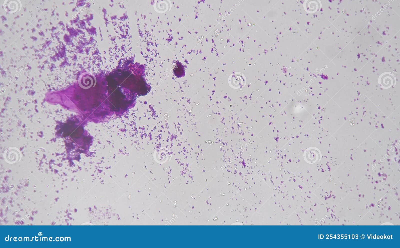 Three Types of Bacteria are Filmed Under Microscope Against Bright ...