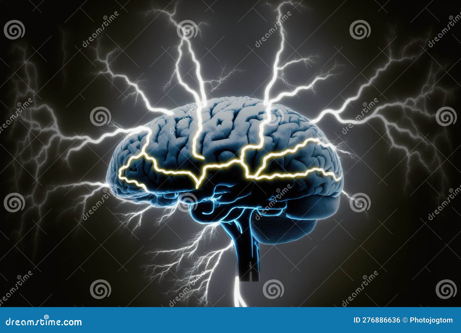 Thunderstorm in the brain stock illustration. Illustration of illness ...