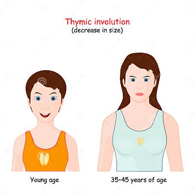 Thymic Involution. Decrease Size of the Thymus with Age Stock Vector ...