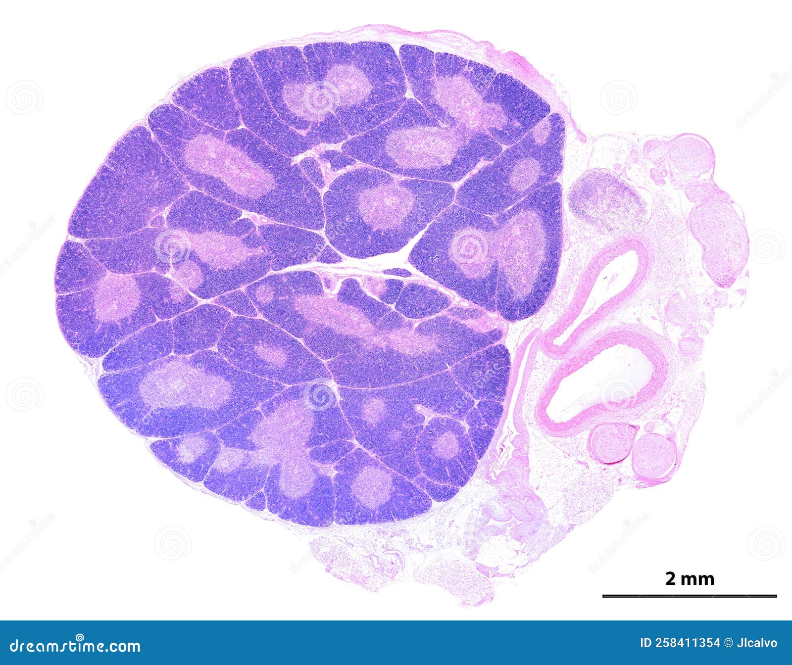 Thymus. Cortex and medulla stock photo. Image of histology - 258411354