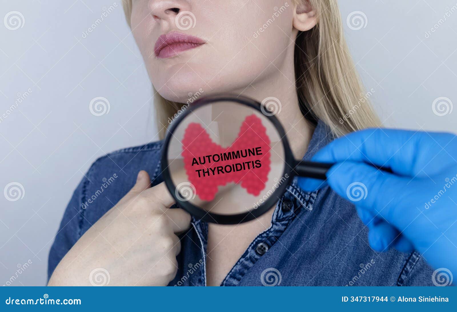 Thyroid Disease - Autoimmune Thyroiditis. the Doctor Examines the ...