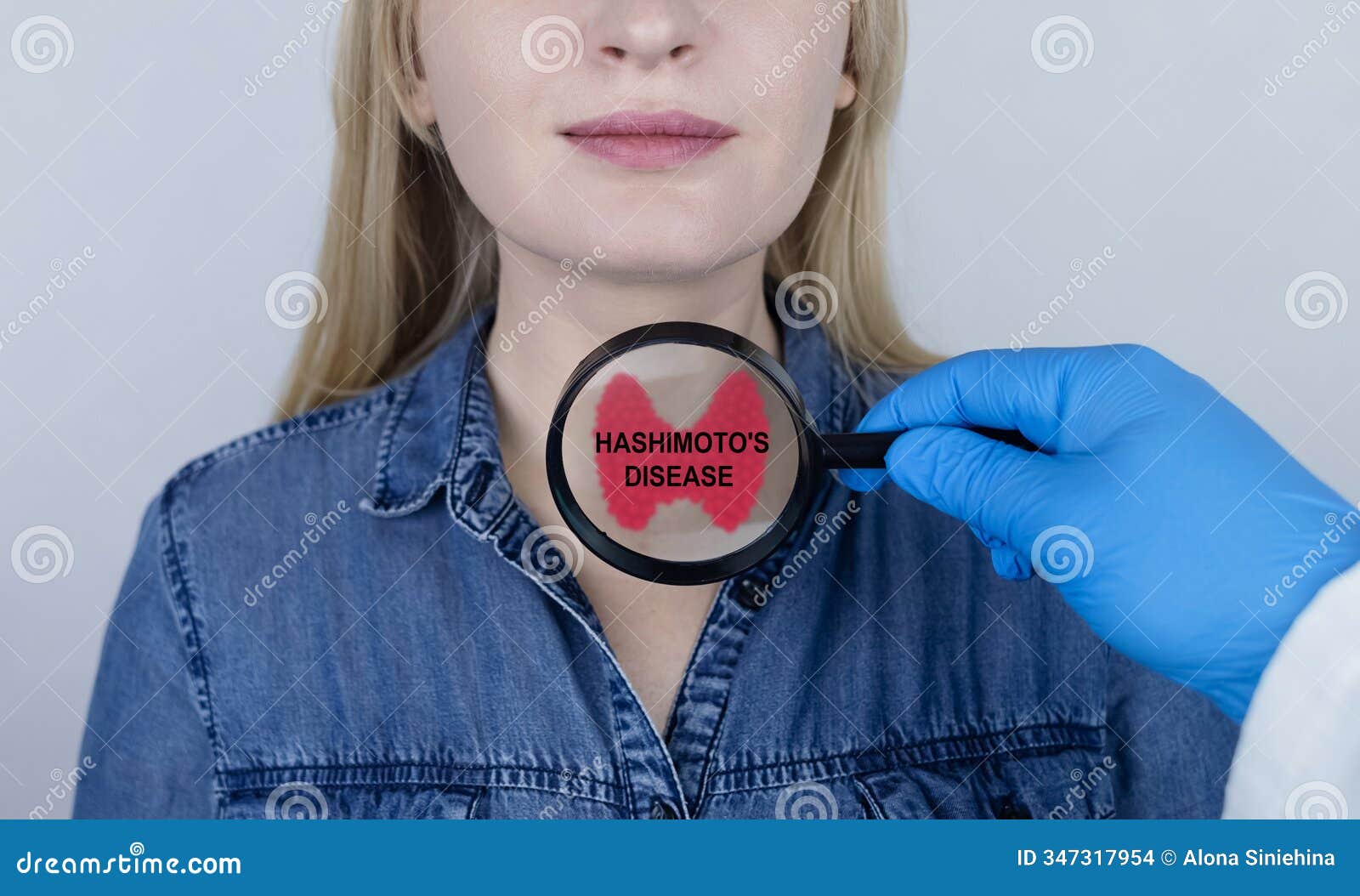An Endocrinologist Examines An Enlarged Thyroid Gland In A Young Girl ...