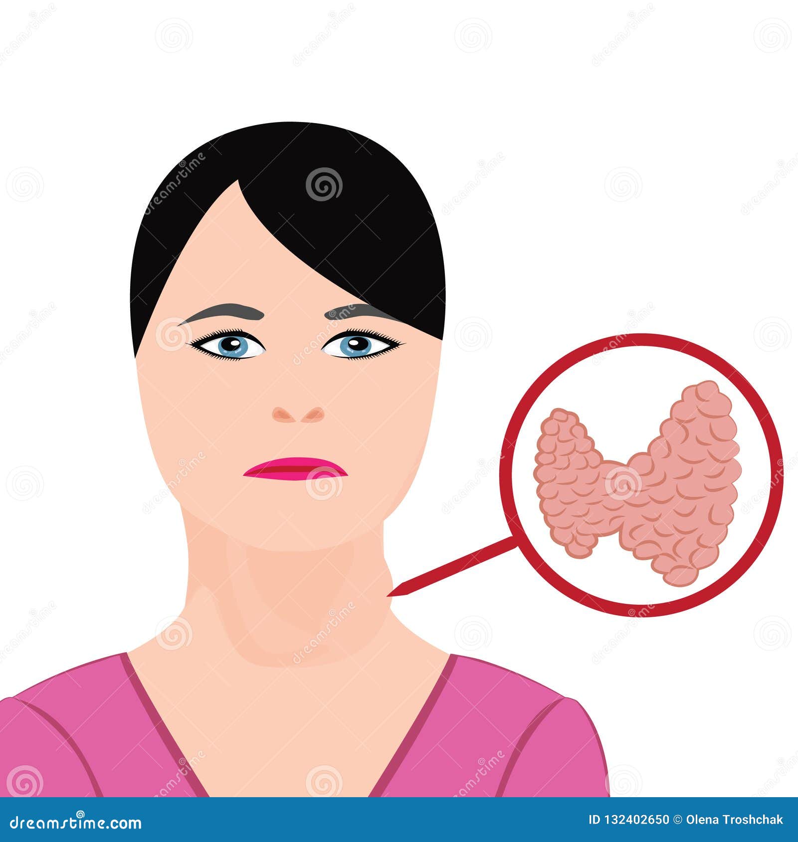 Goitre Disease Vector | CartoonDealer.com #130029237