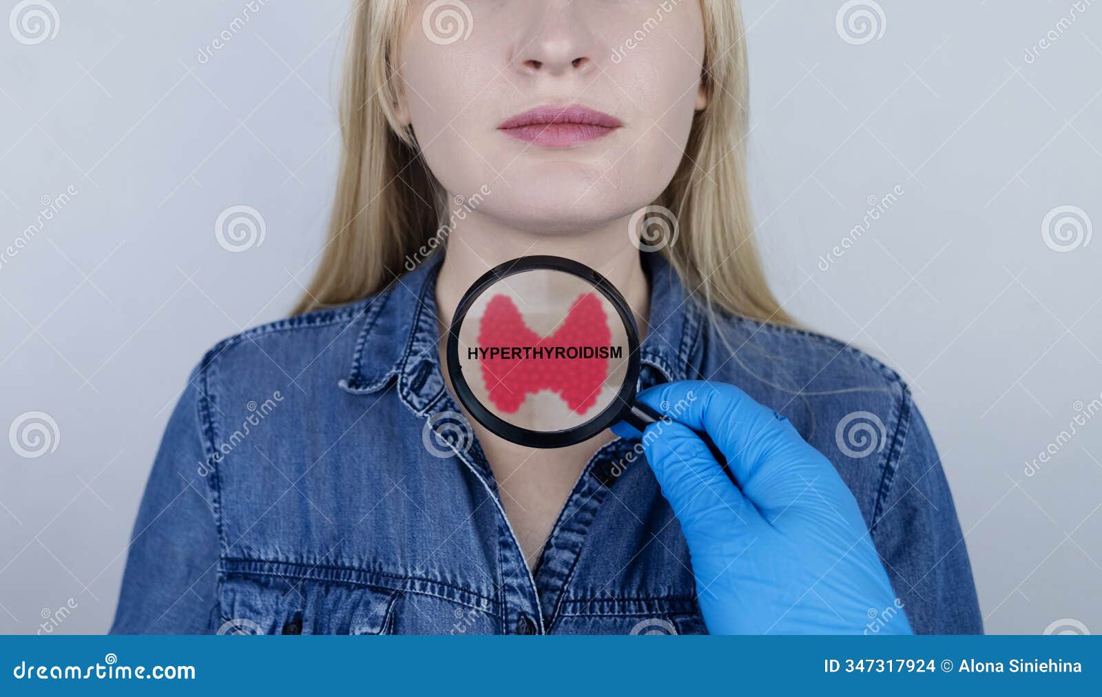 Thyroid Disease - Hyperthyroidism. the Doctor Examines the Patient S ...