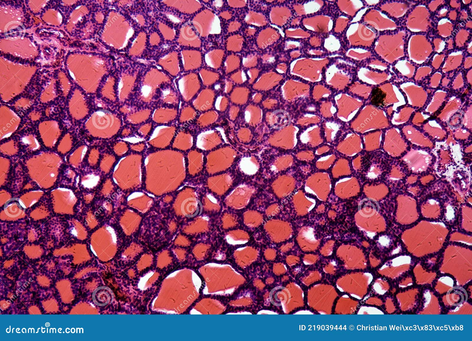 Thyroid Gland Cells Under the Microscope Stock Photo - Image of ...
