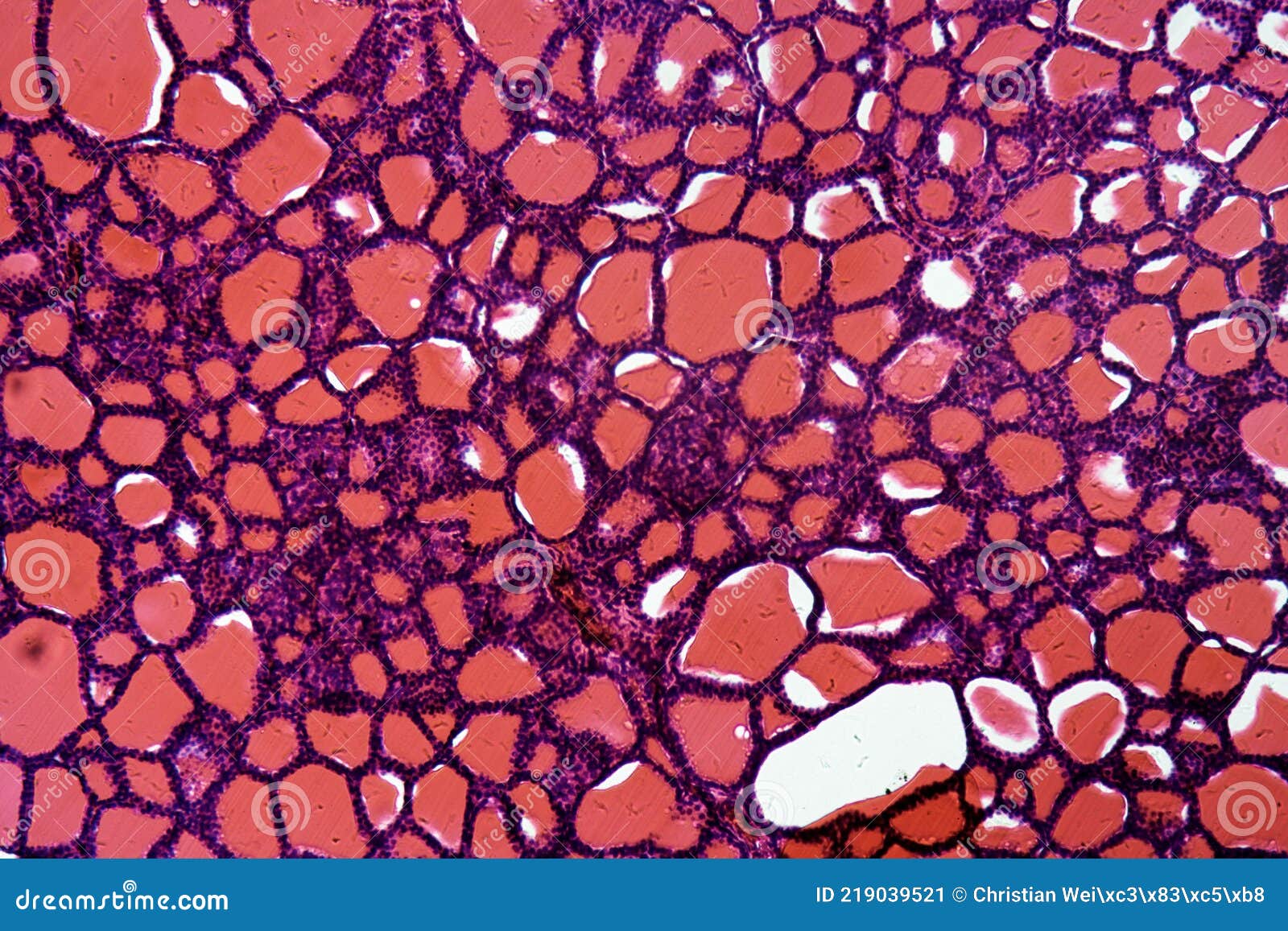 Thyroid Gland Cells Under the Microscope Stock Image - Image of ...