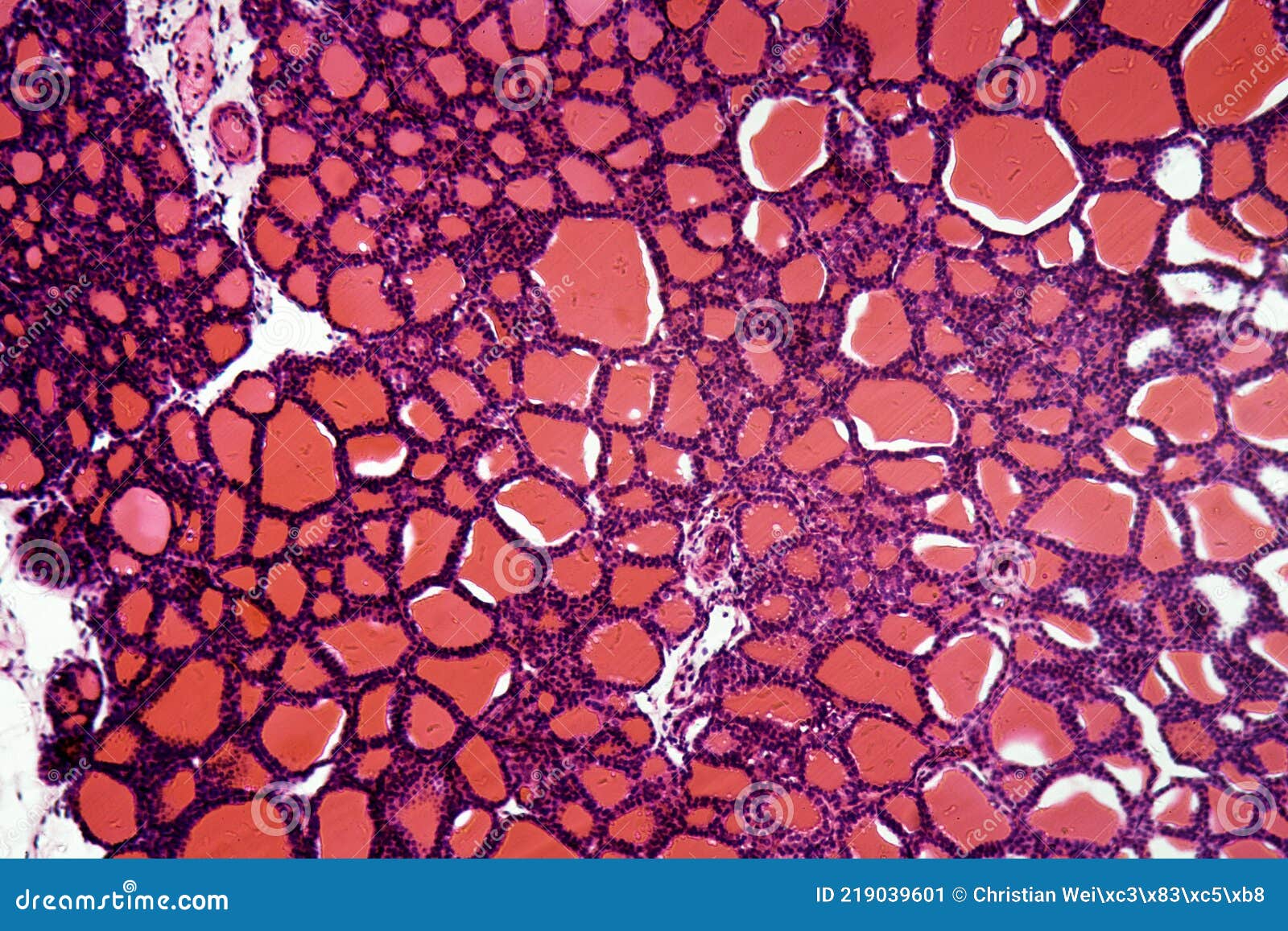 Thyroid Gland Cells Under The Microscope Stock Image Image Of Health Microscopy 219039601