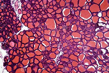 Thyroid Gland Cells Under the Microscope Stock Image - Image of health ...