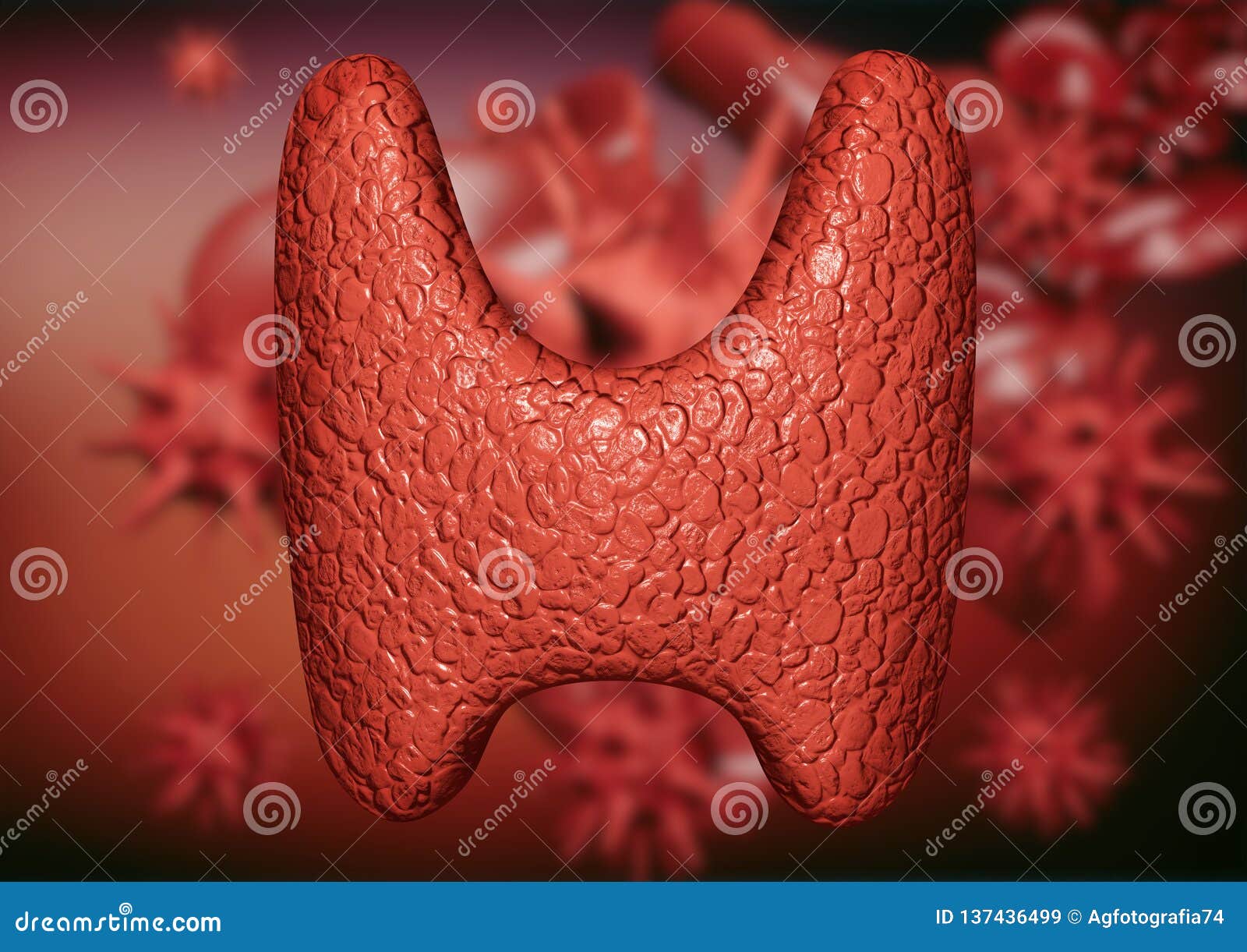 Thyroid Gland Contaminated by Viruses and Bacteria. Commitment of the ...