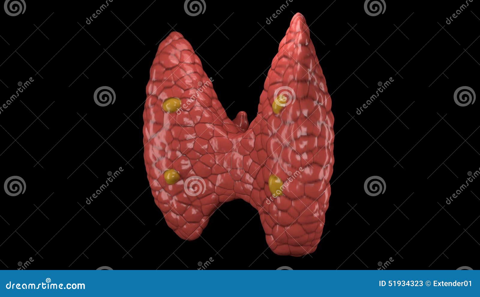Parathyroid Gland Model