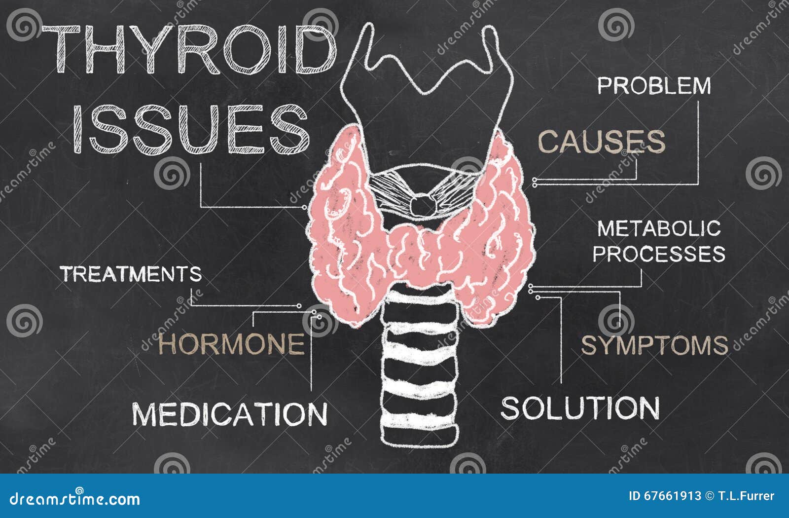 Causes Of Hypothyroidism Thyroid Gland Disease. Endocrine System ...