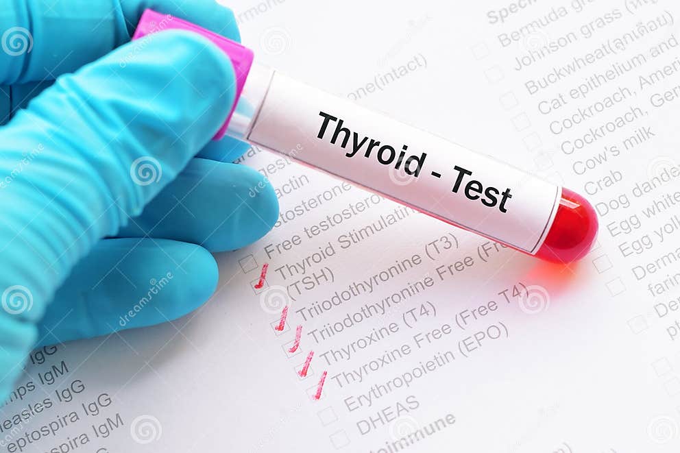 Thyroid panel test stock image. Image of hormone, research - 102498787