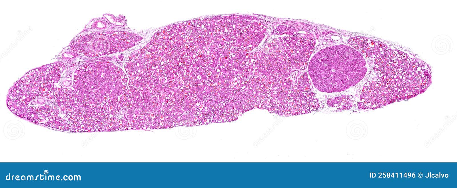 Parathyroid Gland. Doctor Or Teacher Of Medical University Or School ...
