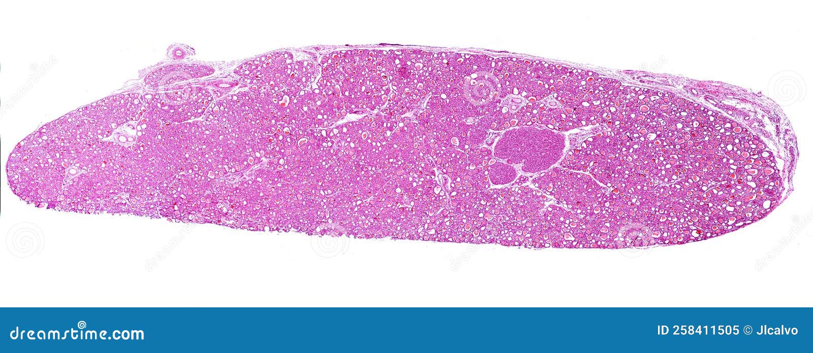 Thyroid and Parathyroid Gland Stock Image - Image of endocrine ...