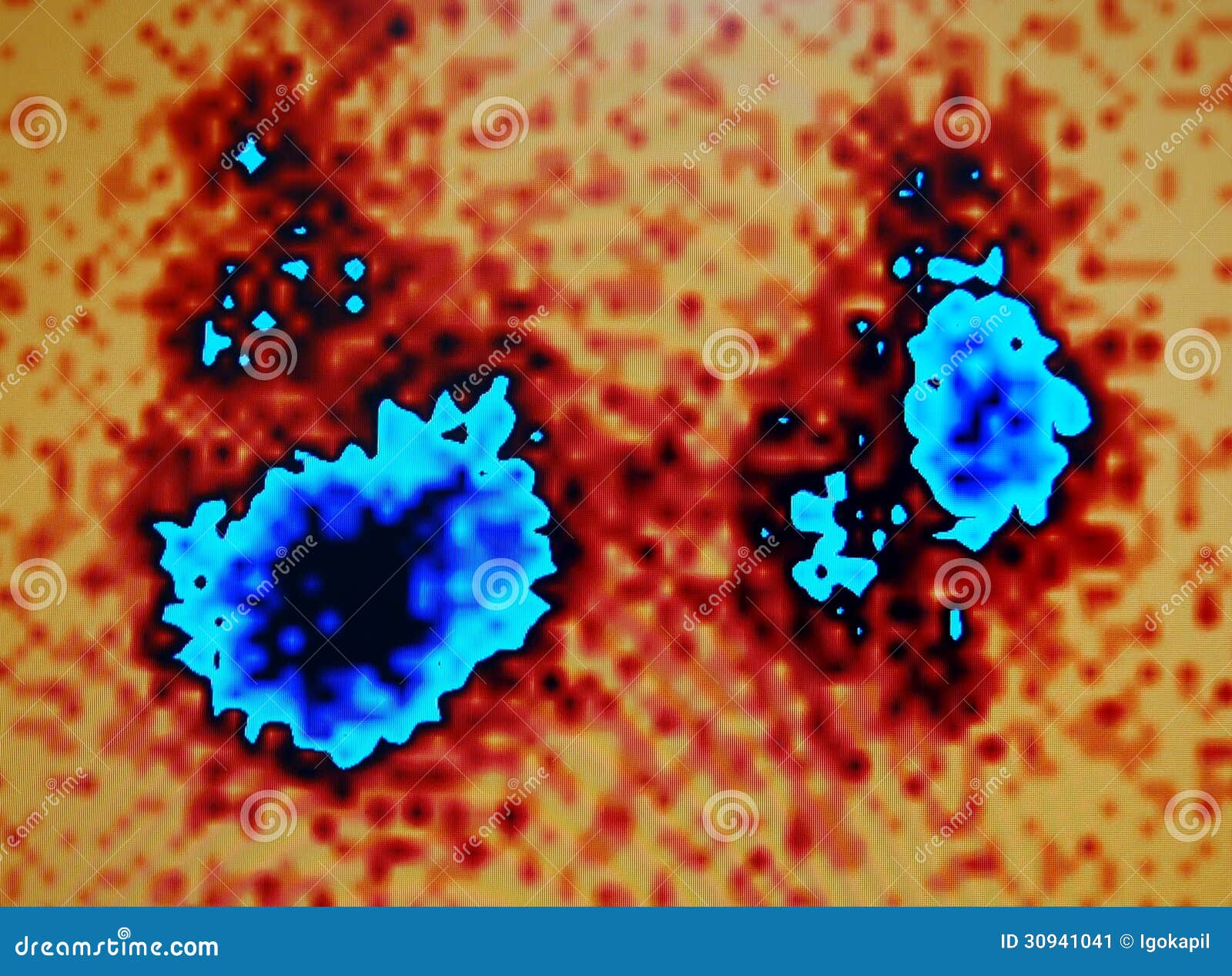 A Pathological Tissue Grossing Section Thin Slice Making Microtome For ...