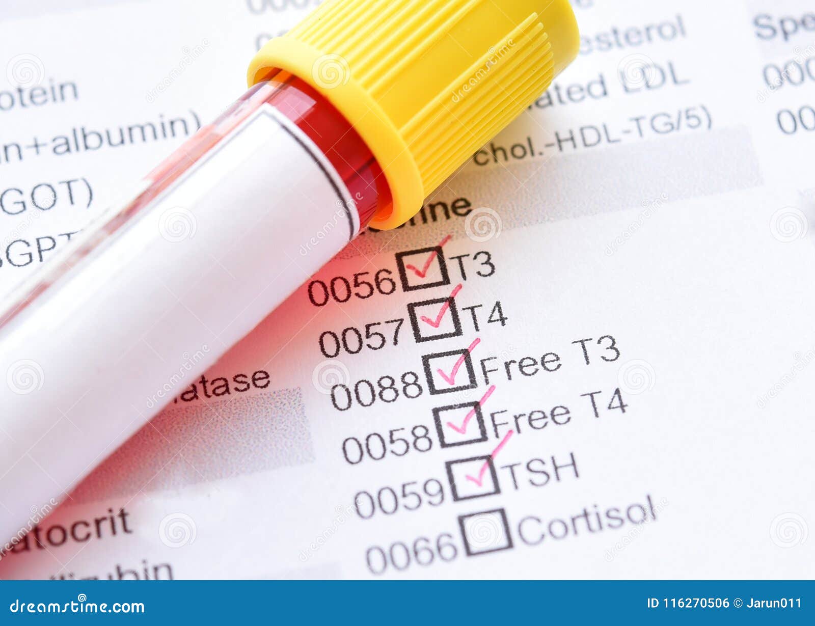 Thyroid profile test stock photo. Image of hospital - 116270506