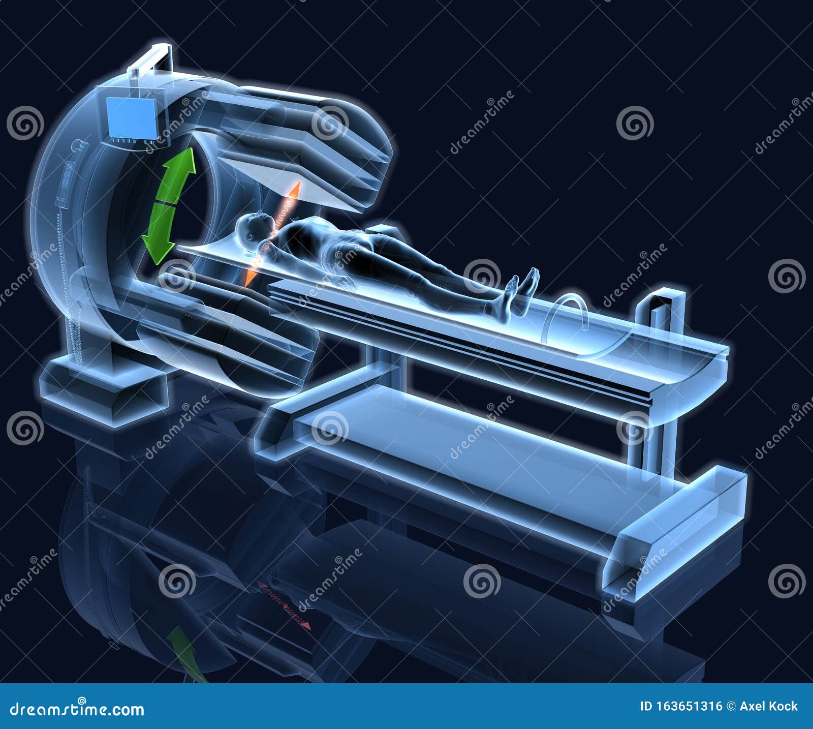 Thyroid Scan of Scintigraphy, Medically 3D Illustration Stock ...