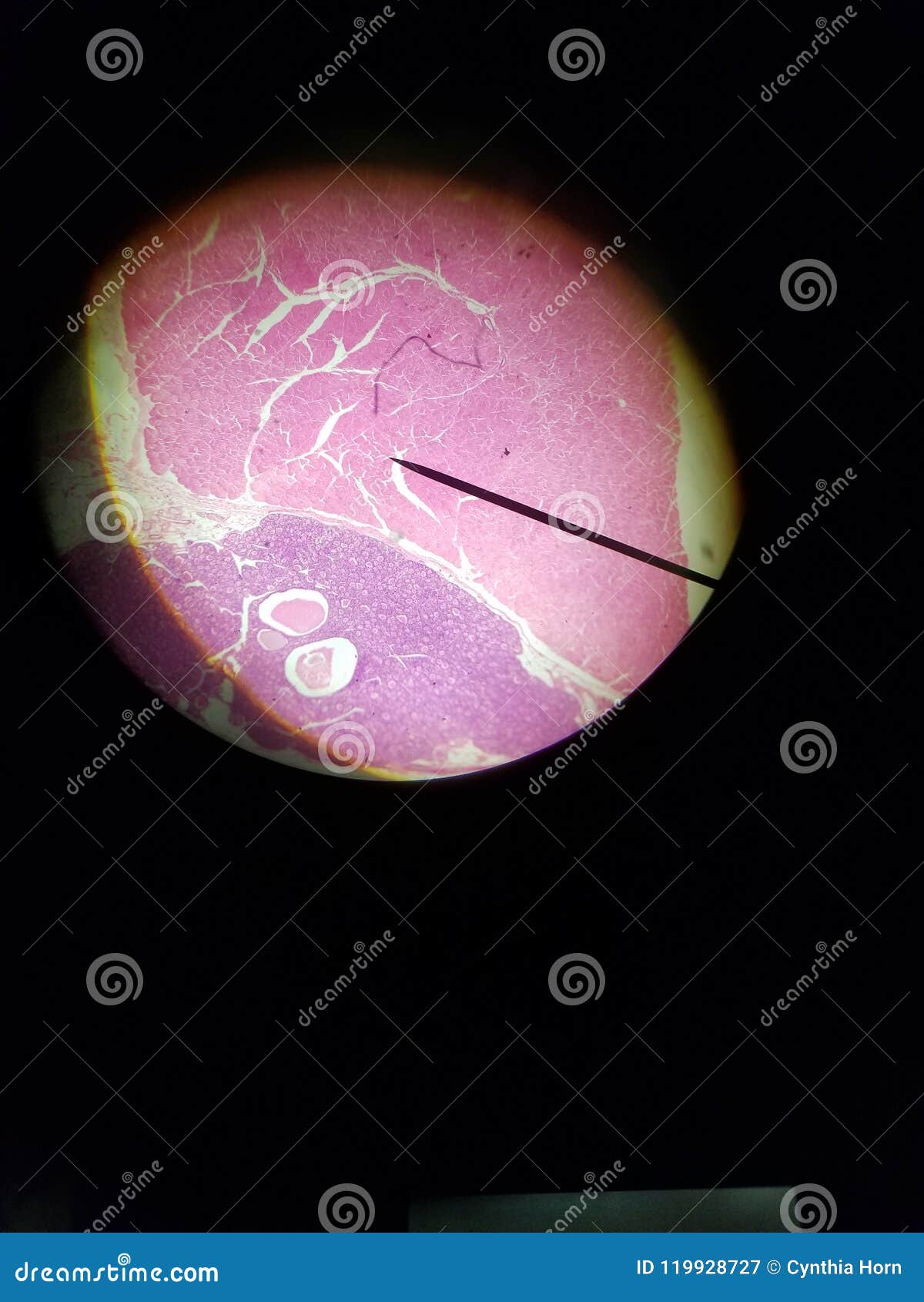 Thyroid under microscope stock image. Image of 400x - 119928727
