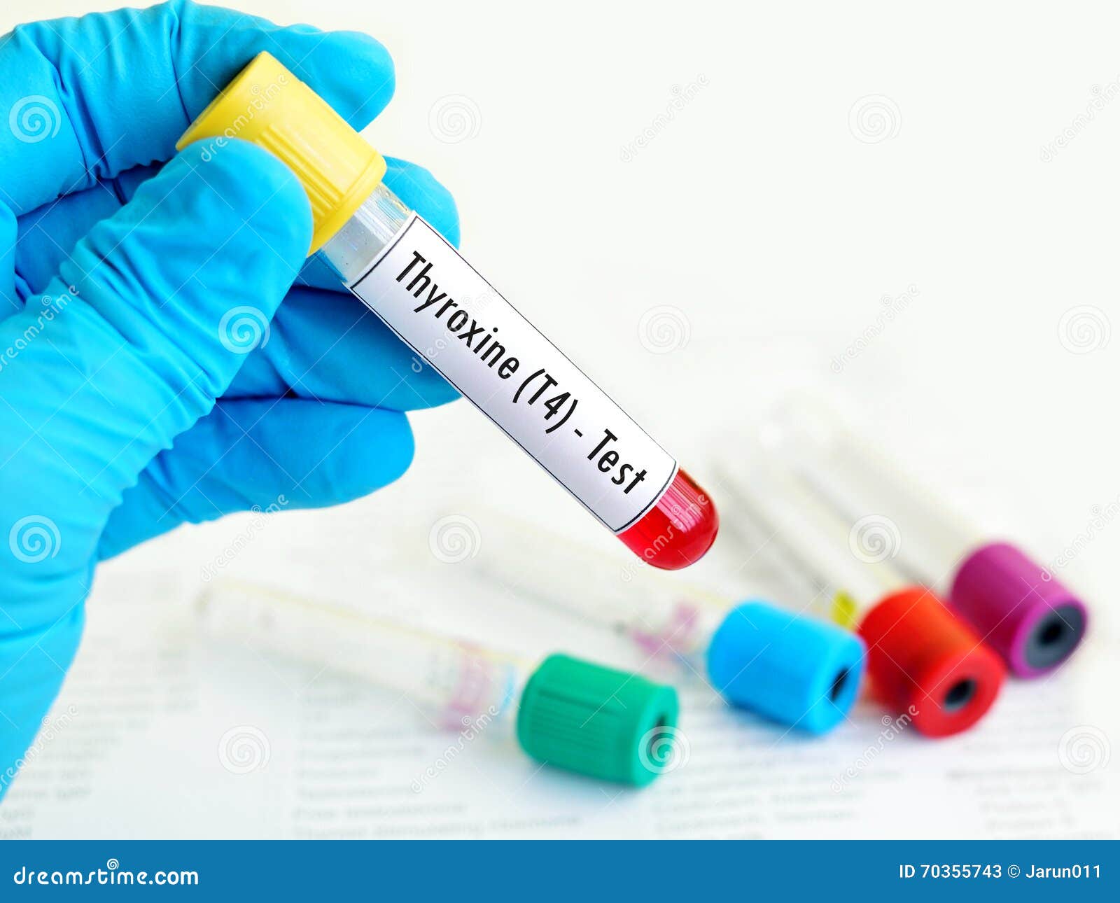 Thyroxine test stock image. Image of experiment, hyperthyroidism - 70355743