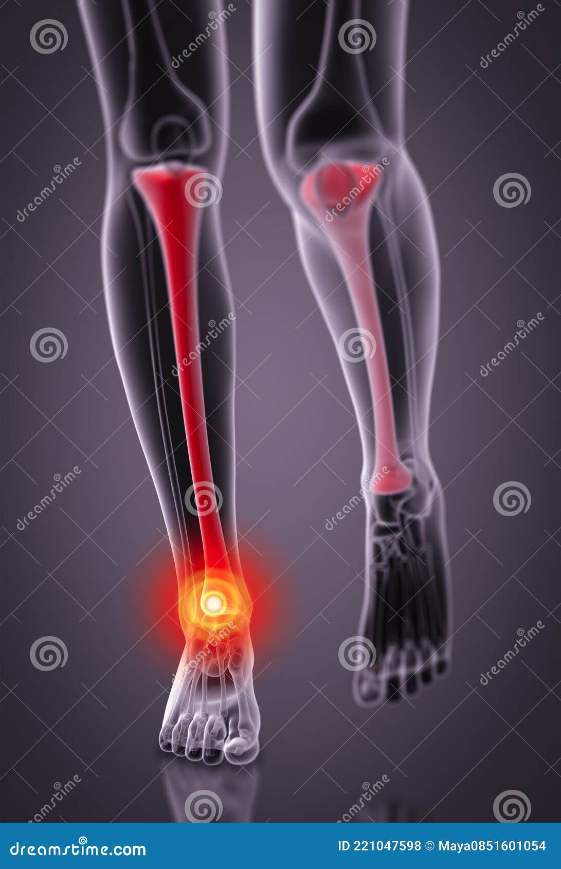 3D Rendering Illustration of Tibia Bone Stock Illustration ...
