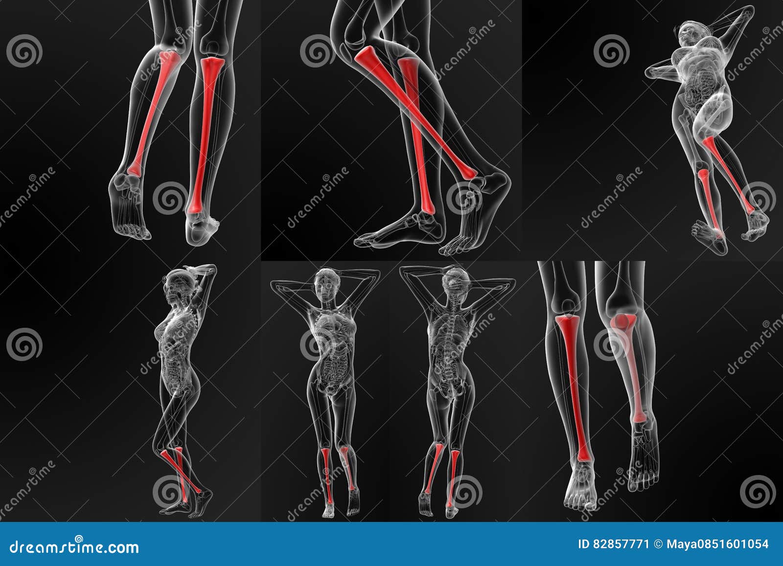 Tibia Bone Royalty-Free Illustration | CartoonDealer.com #82857771