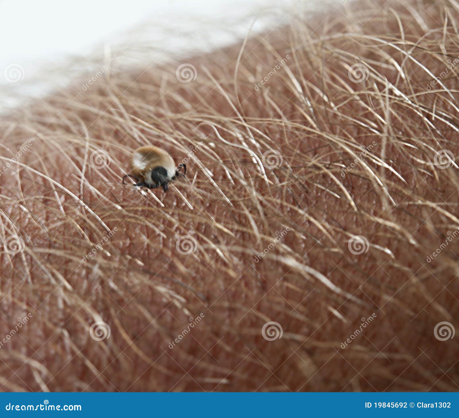 Tick stock photo. Image of sickness, detail, borreliosis - 19845692