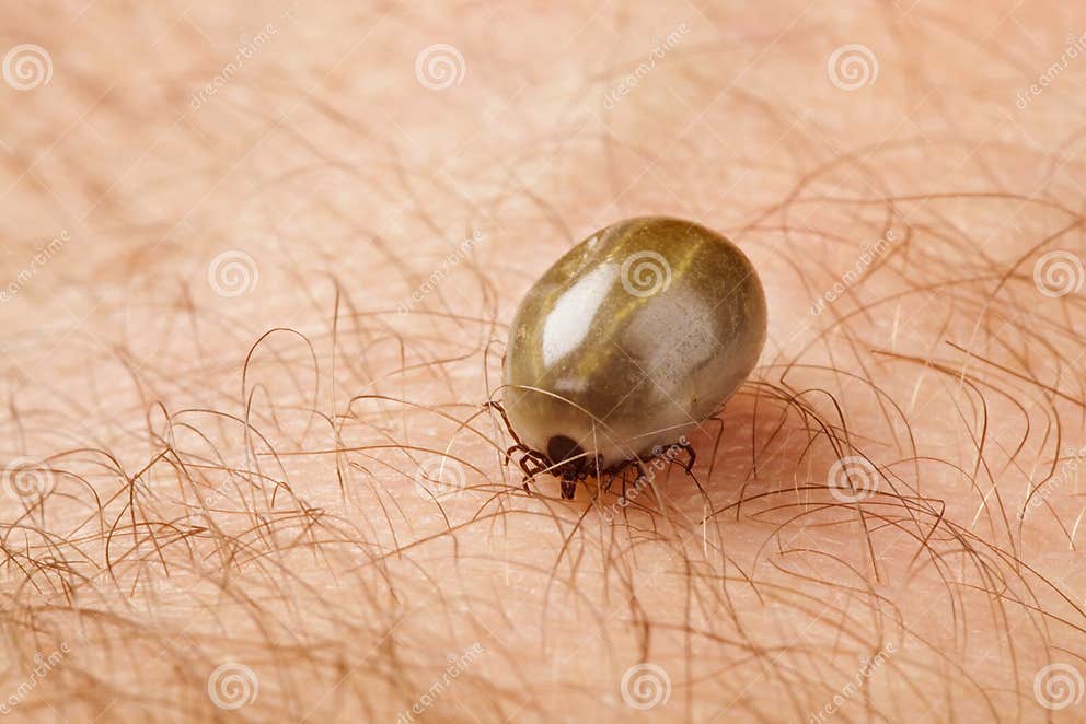 Tick stock image. Image of single, sucking, disease, tick - 19932265