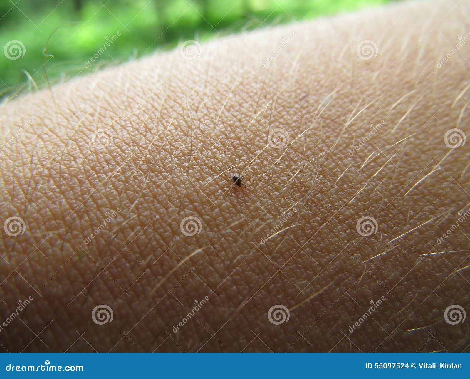 Tick on arm stock photo. Image of insects, lone, macro - 55097524