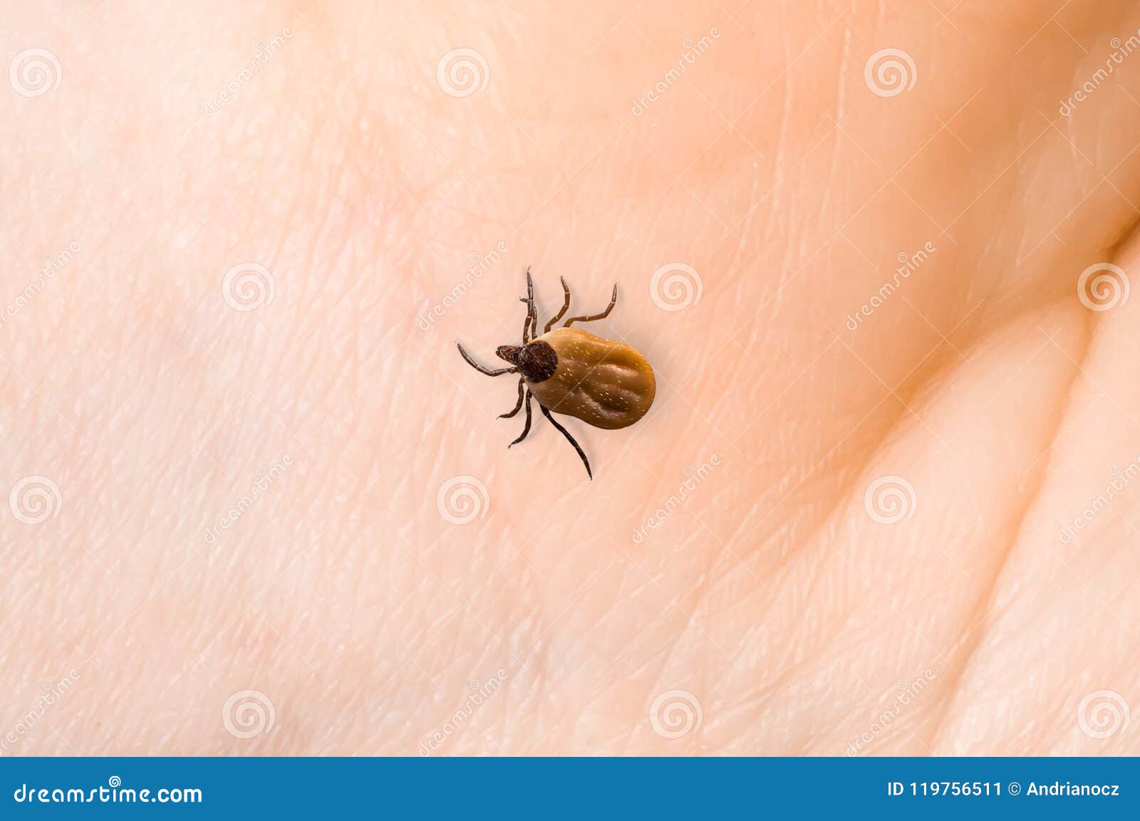 Tick is Crawling on Human Body Stock Image - Image of pest, human ...