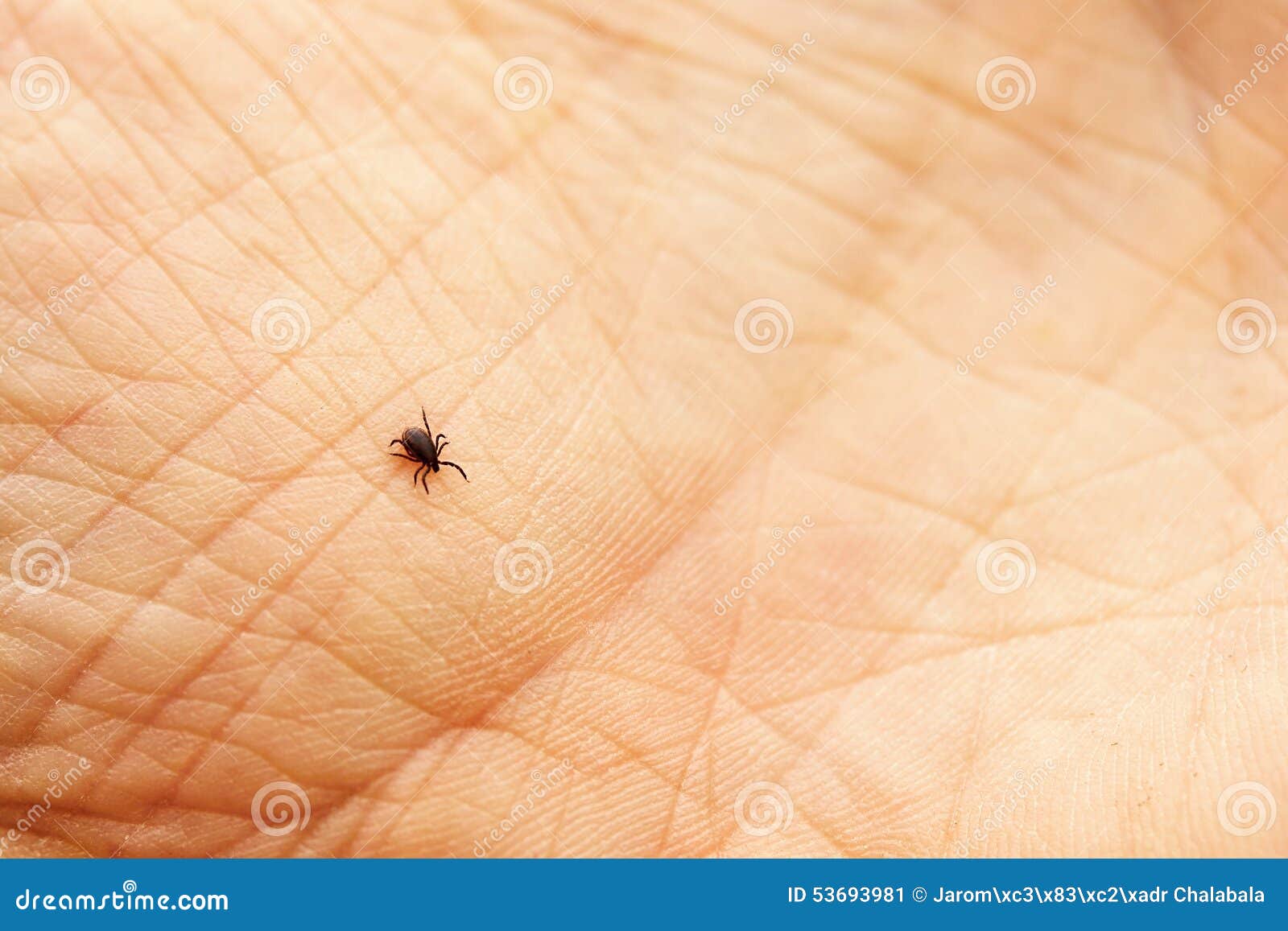 Tick stock image. Image of ectoparasites, biology, borreliosis - 53693981