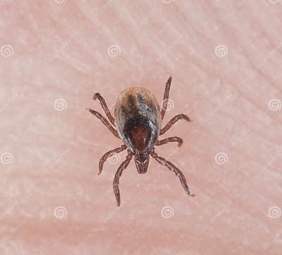 Tick Crawling on Human Skin Stock Image - Image of borreliose, hyalomma ...