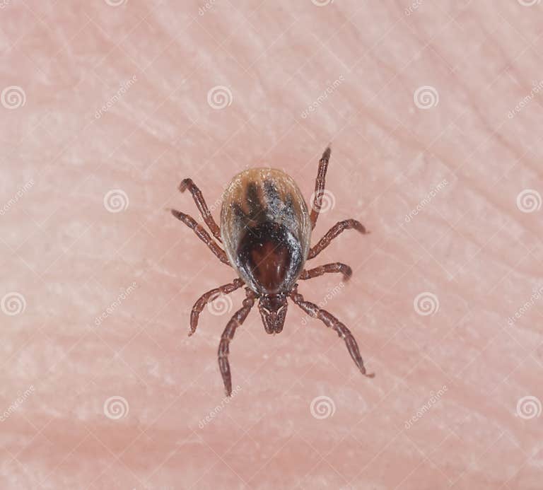 Tick Crawling on Human Skin Stock Image - Image of borreliose, hyalomma ...