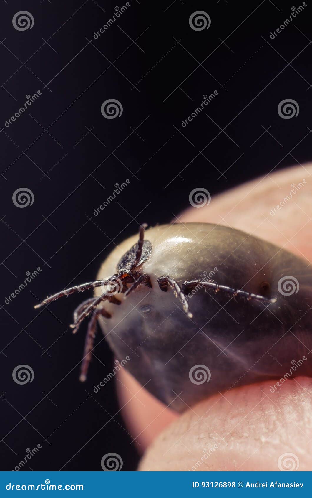 Tick Filled with Blood Sitting on Human Skin Stock Photo - Image of ...
