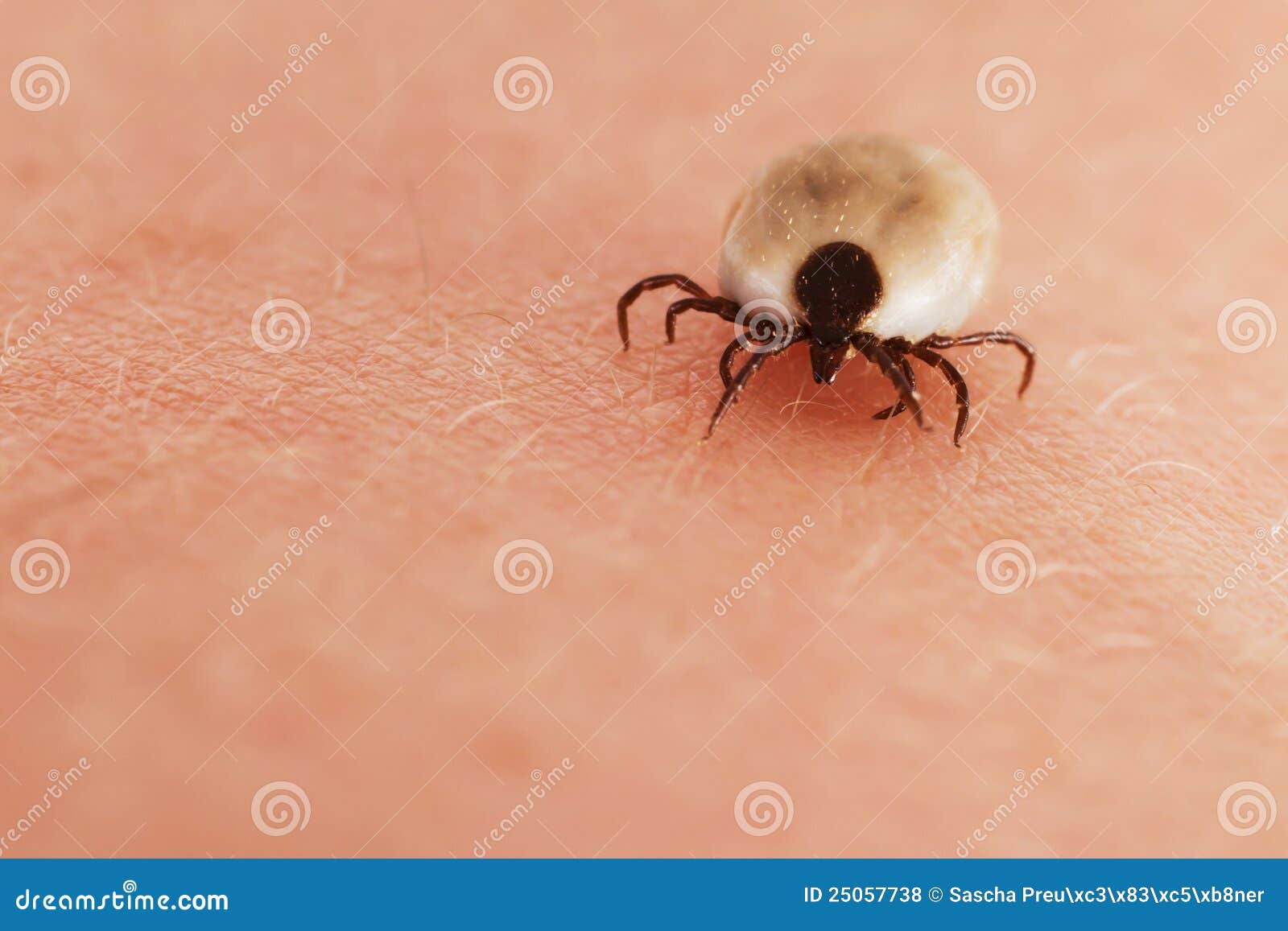 Tick on human skin stock photo. Image of arachnid, dangerous - 25057738